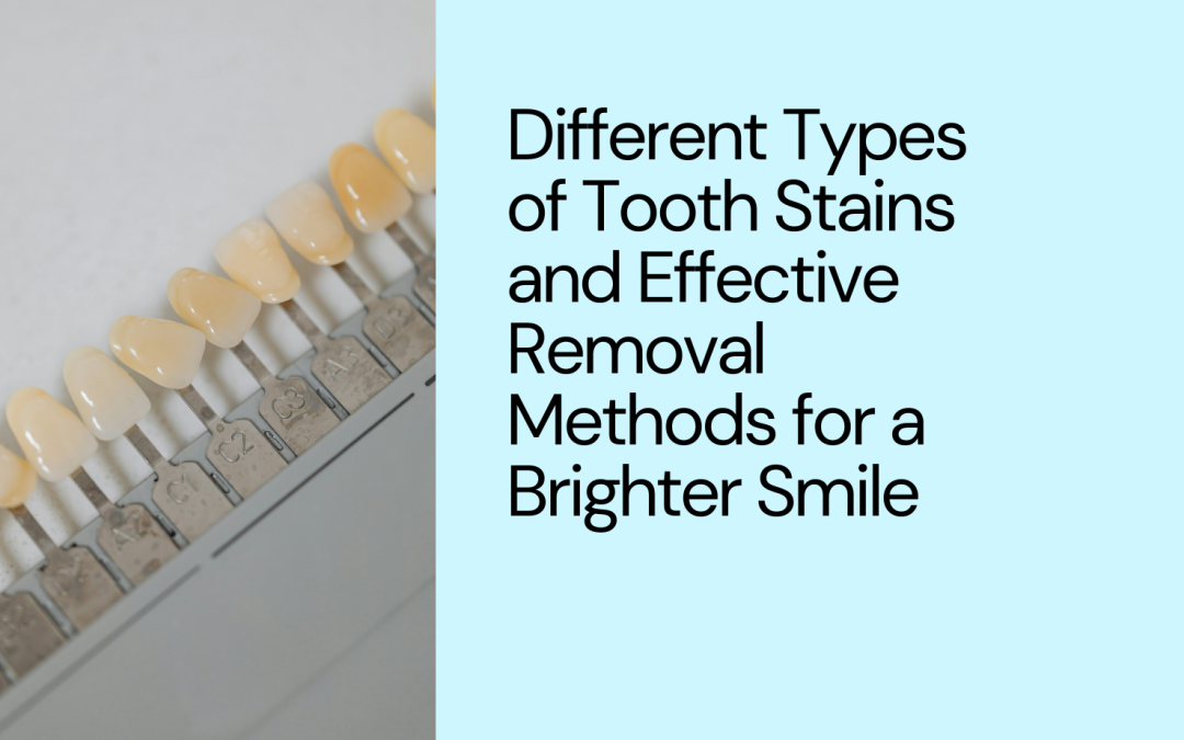 stains in teeth - Tooth Wellness