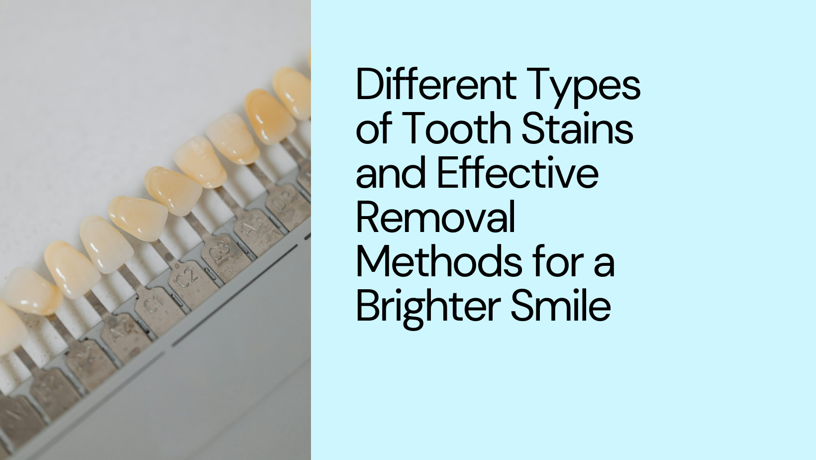 Different Types of Tooth Stains and Effective Removal Methods for a ...