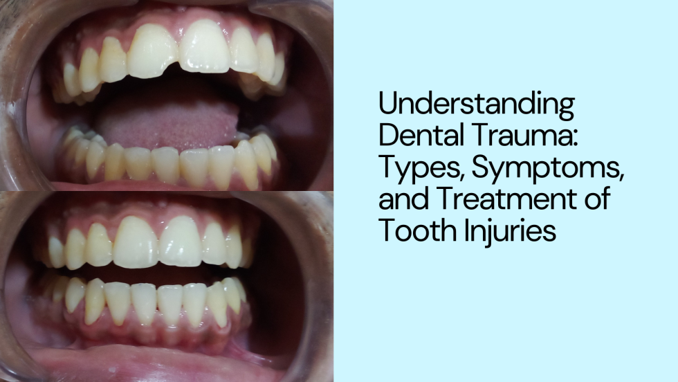 Understanding Dental Trauma: Types, Symptoms, and Treatment of Tooth ...